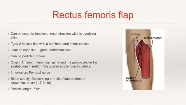 Muscle flaps and their blood supply.pptx | Death, Injury, or Military ...