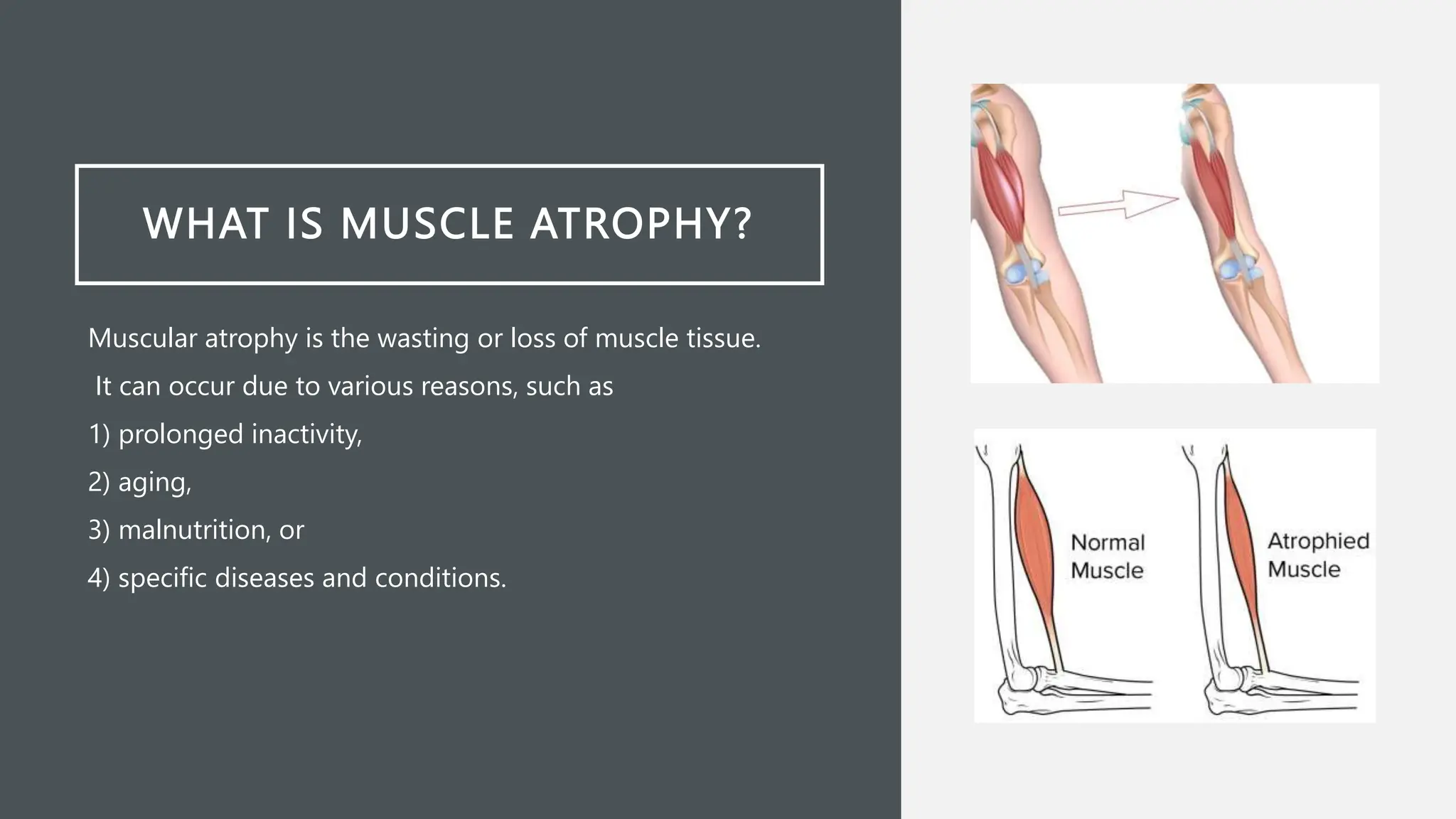 Muscle Hypertrophy.pptx
