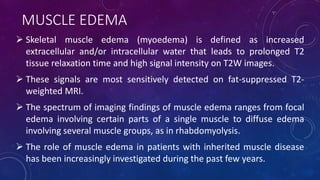 Muscle MRI in Neuromuscular Disease | PPTX