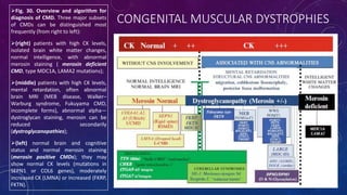 Muscle MRI in Neuromuscular Disease | PPTX