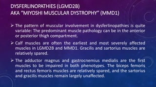 Muscle MRI in Neuromuscular Disease | PPTX