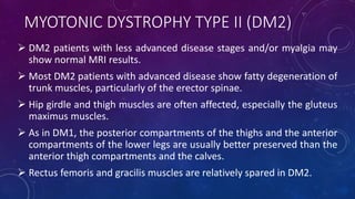 Muscle MRI in Neuromuscular Disease | PPTX