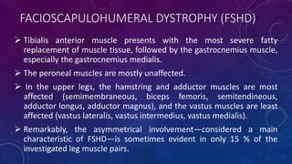 Muscle MRI in Neuromuscular Disease | PPTX