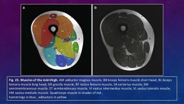 Upper Thigh Muscles Ct Anatomy : Normal Anatomy Of The Sciatic Nerve A ...