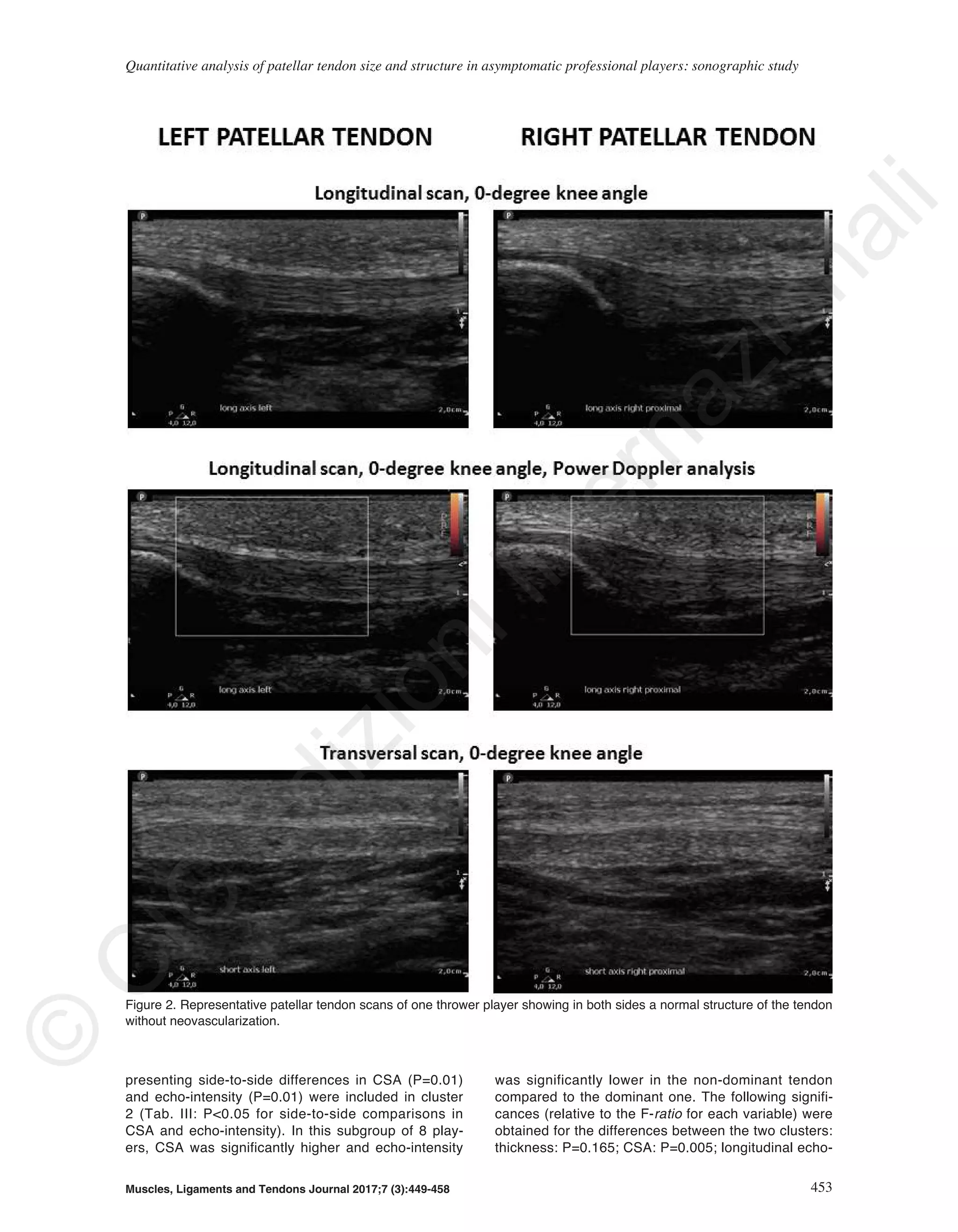 Quantitative analysis of patellar tendon size and structure in ...