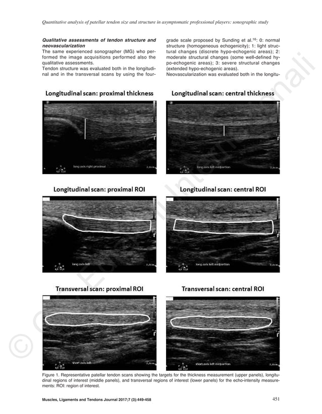 Quantitative analysis of patellar tendon size and structure in ...