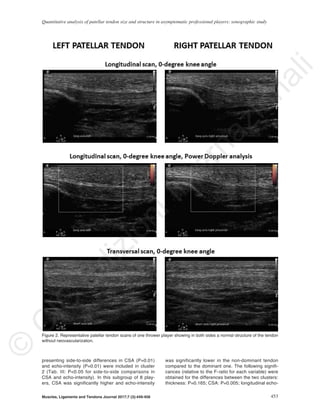 Quantitative analysis of patellar tendon size and structure in ...