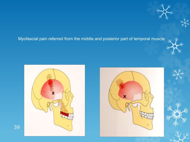 Muscle of mastication | PPT
