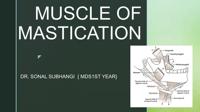 muscle of mastication.pptx | Death, Injury, or Military Conflict ...