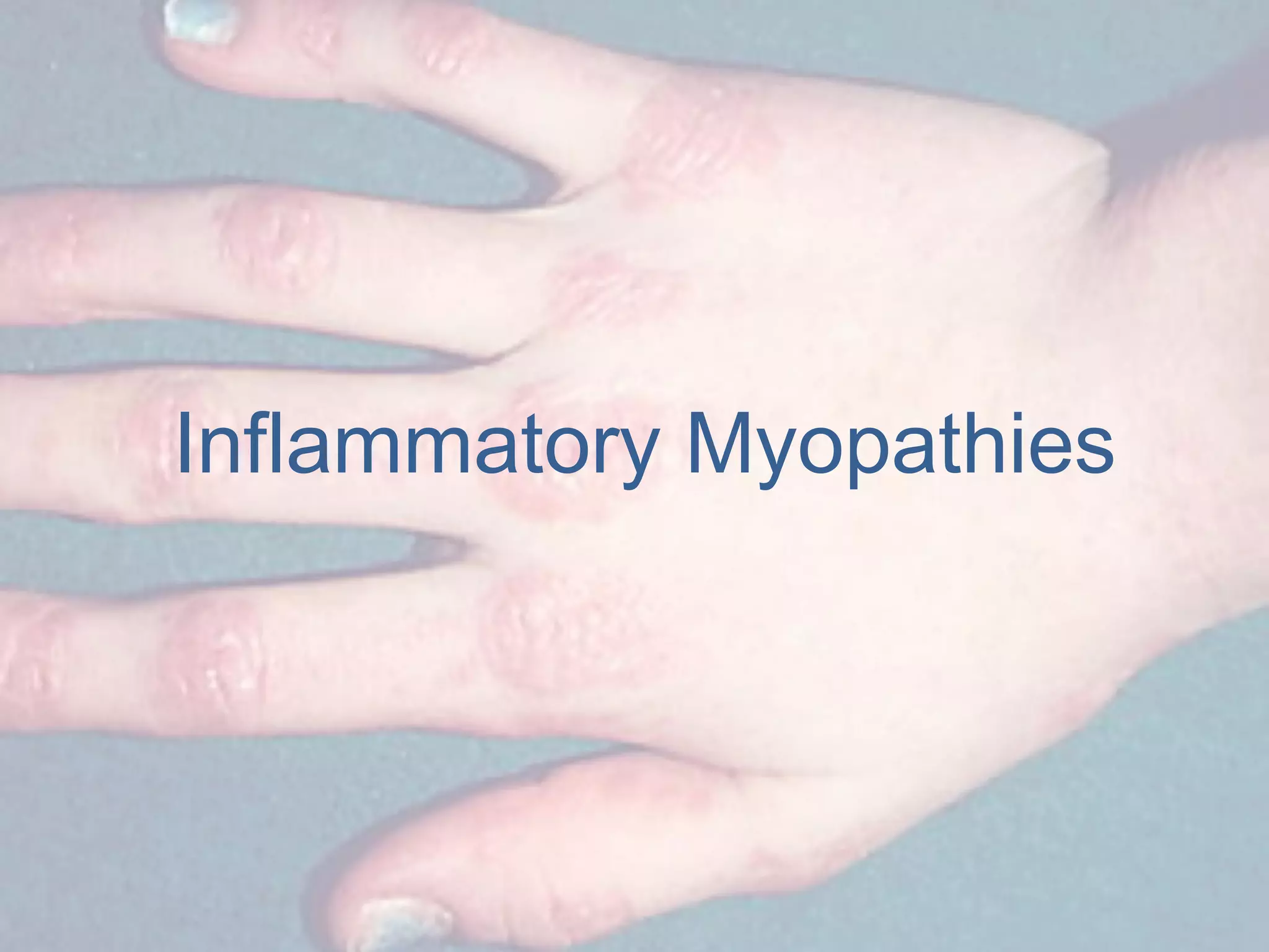 Myopathies - In detail (Classification and images) | PPT