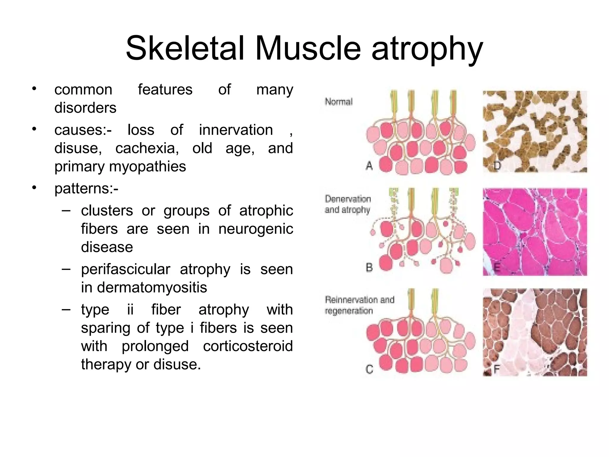 Myopathies - In detail (Classification and images) | PPT