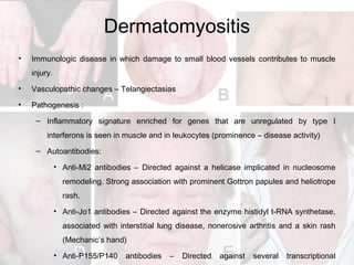 Myopathies - In detail (Classification and images) | PPT
