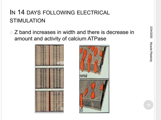 Muscle plasticity | PPTX | Physical Therapy | Wellness
