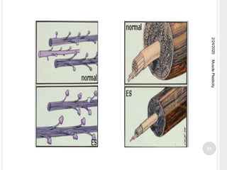 Muscle plasticity | PPTX
