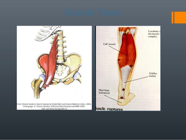 Biarticular Muscle Examples