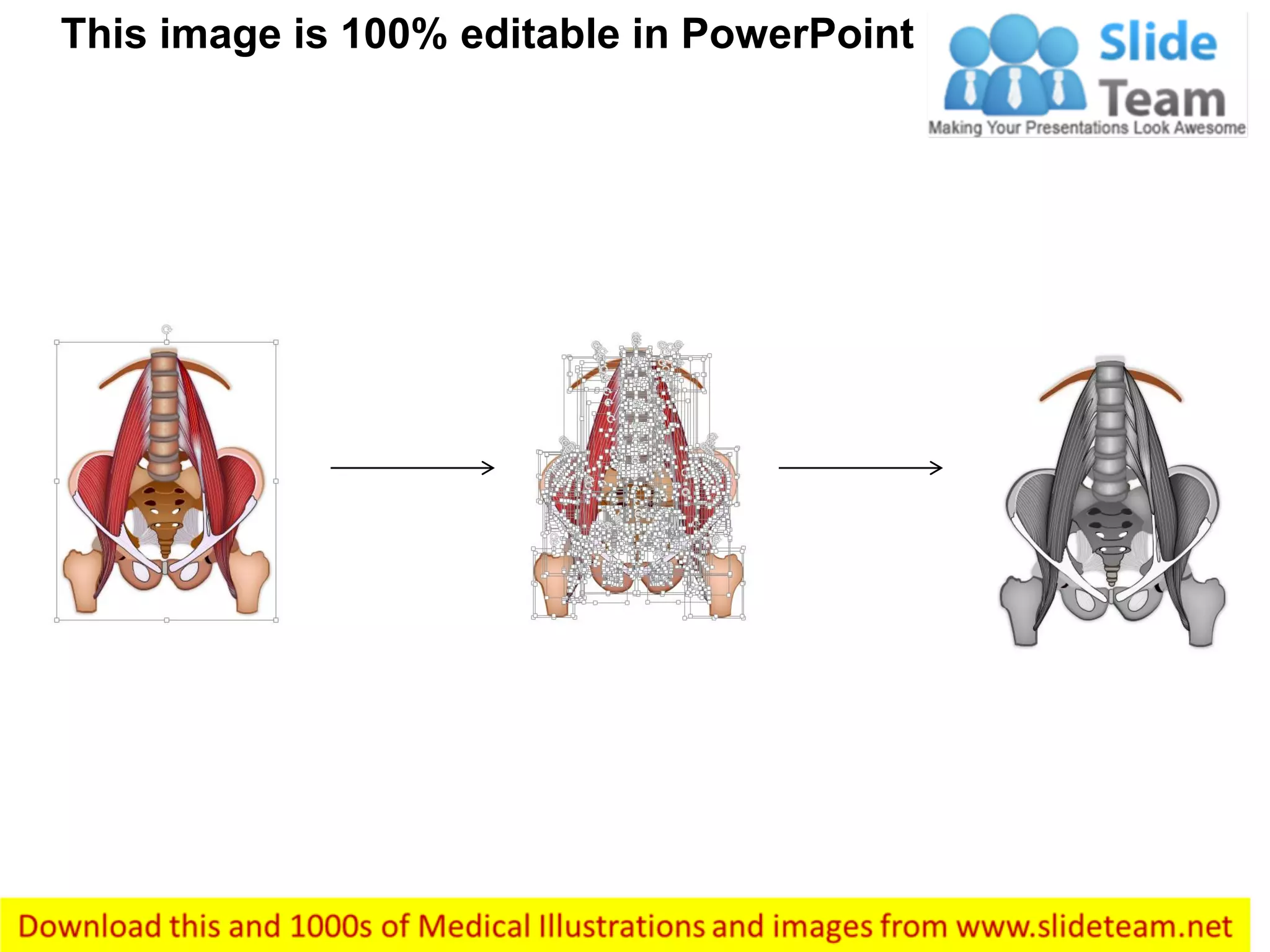 Muscles in-hip medical images for power point | PPT
