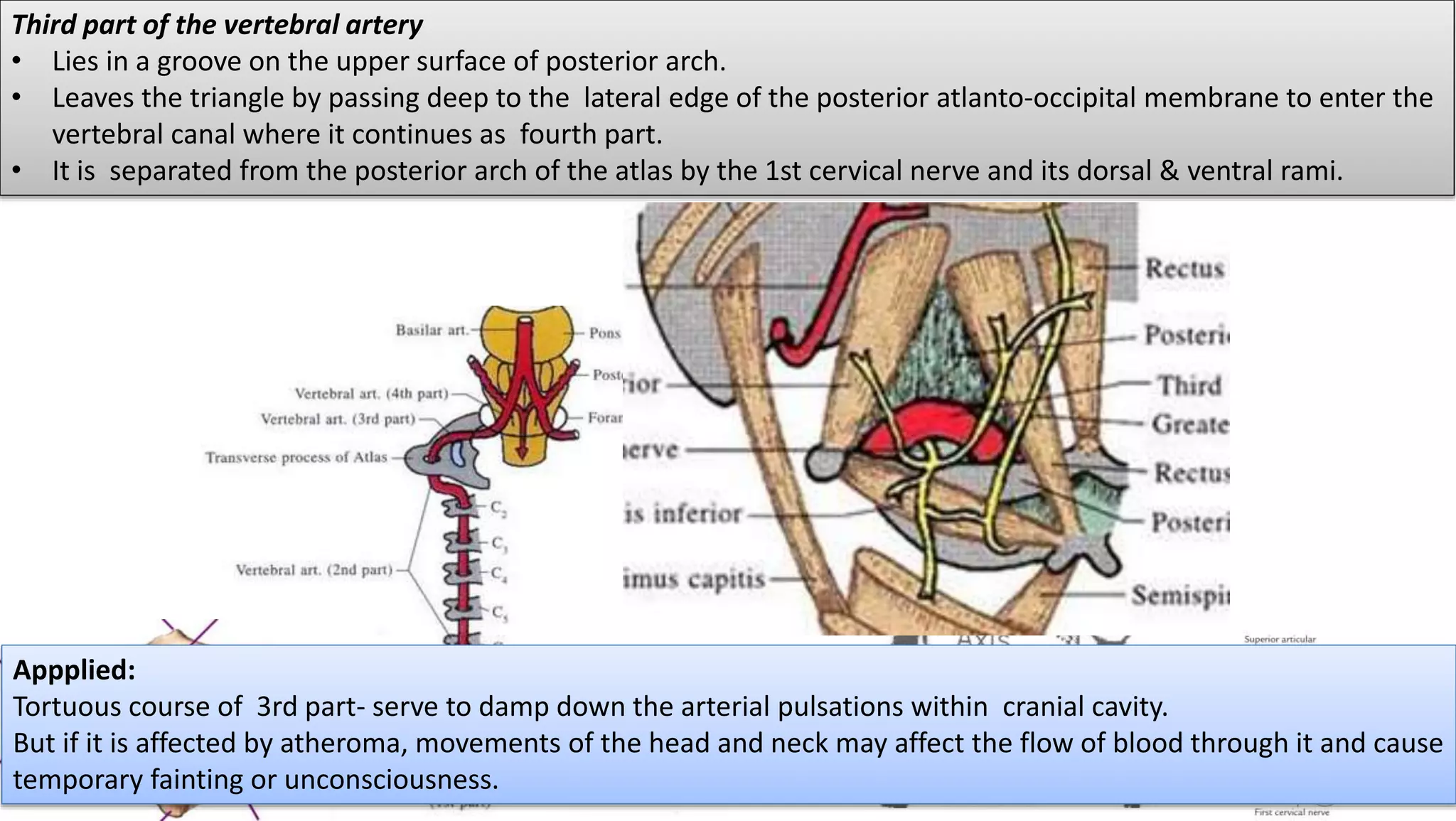 Muscles of back, Suboccipital triangle | PPT