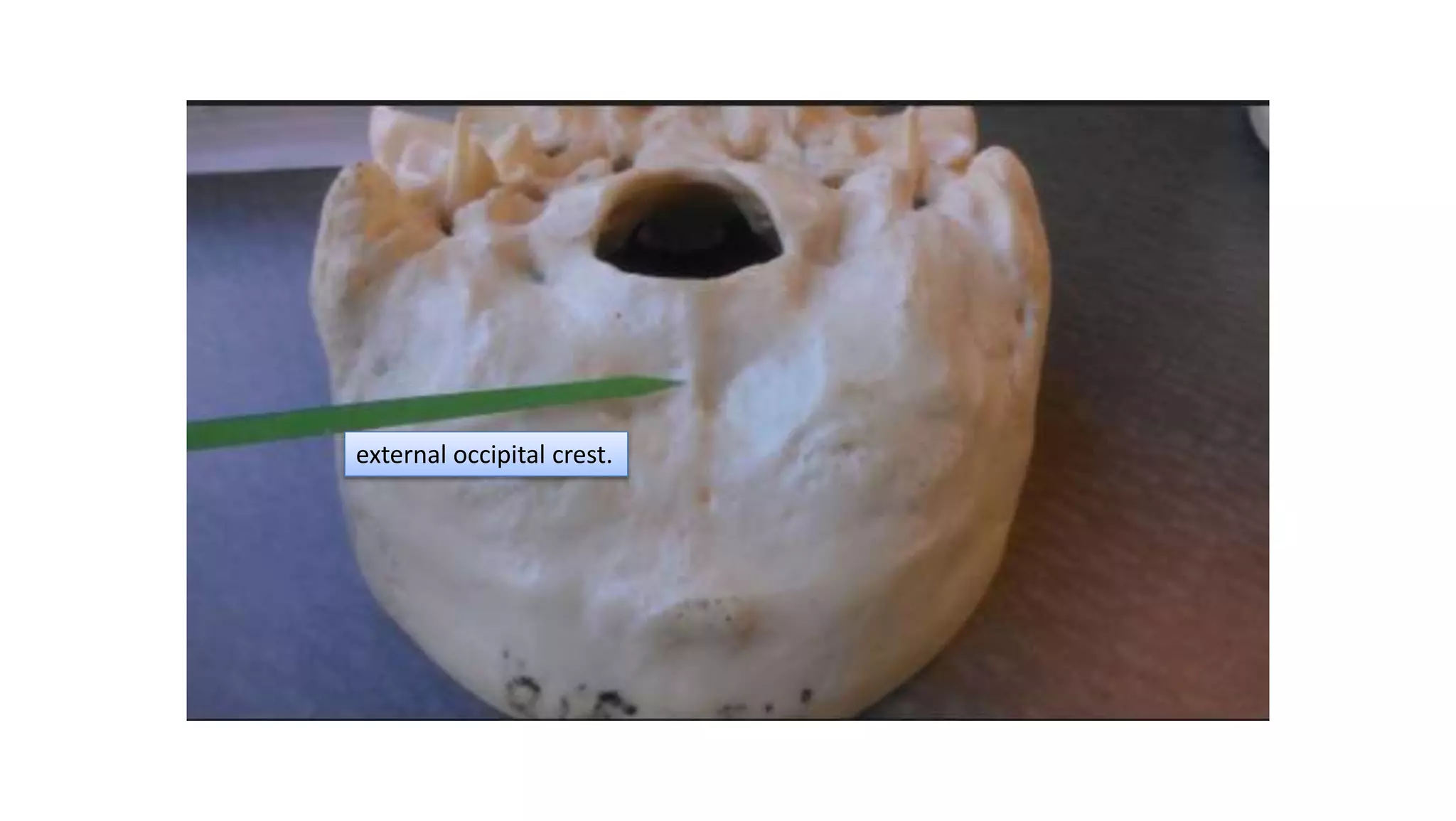 Muscles of back, Suboccipital triangle | PPT