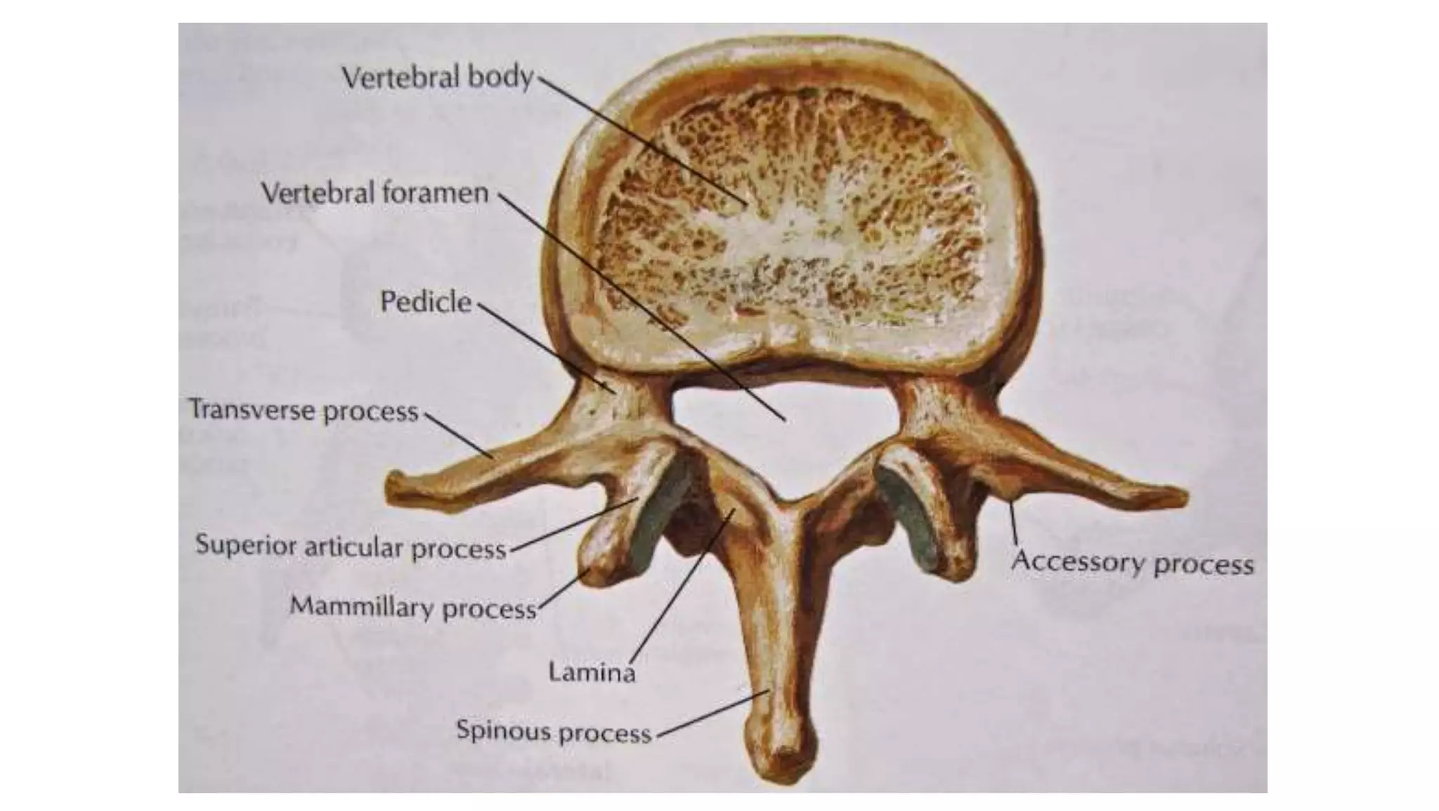 Muscles of back, Suboccipital triangle | PPT