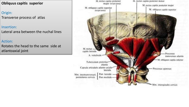 Muscles of back, Suboccipital triangle | PPT