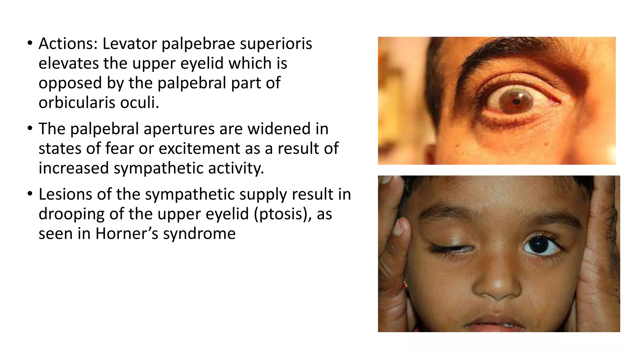 Muscles of Face.pptx