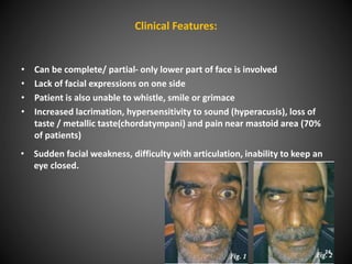 Muscles of facial expression neeha | PPTX