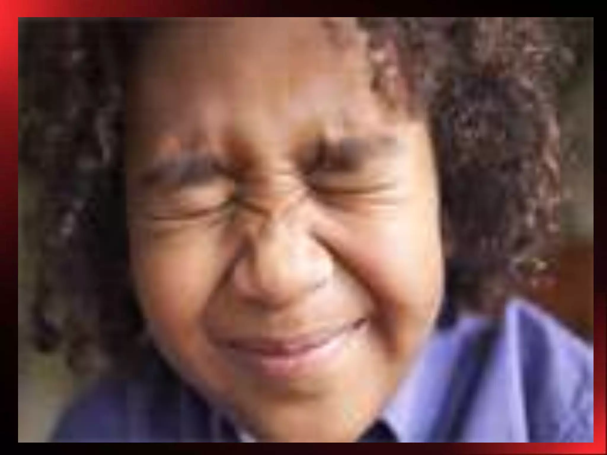 Muscles of facial expressions | PPTX