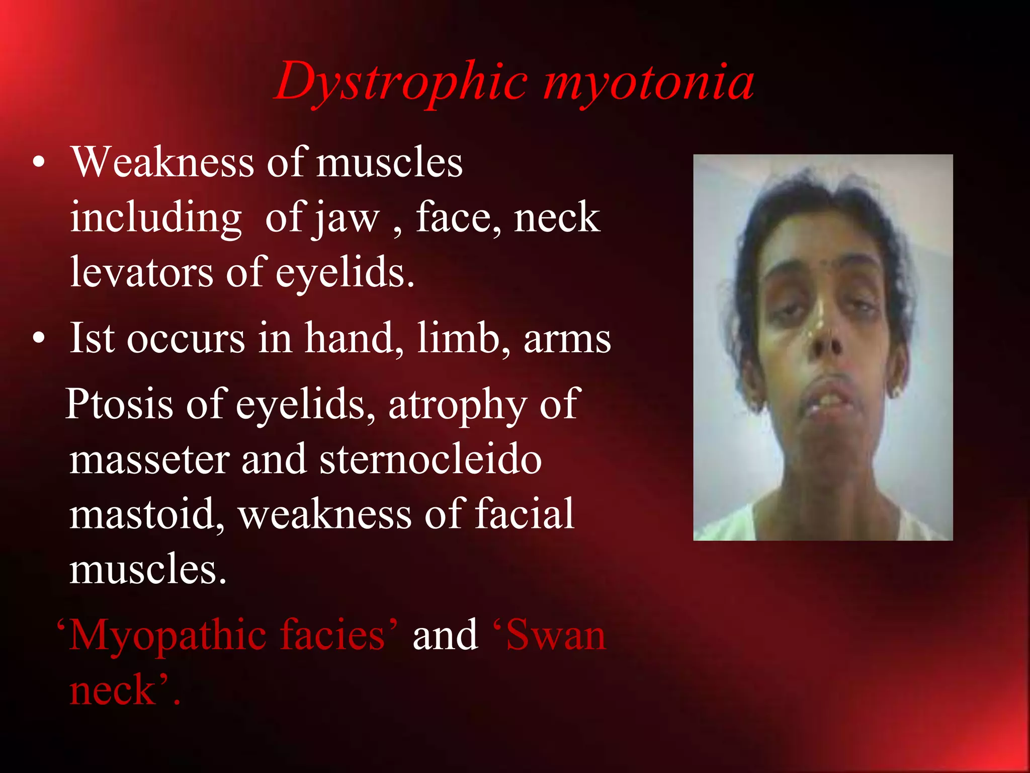 Muscles of facial expressions | PPTX