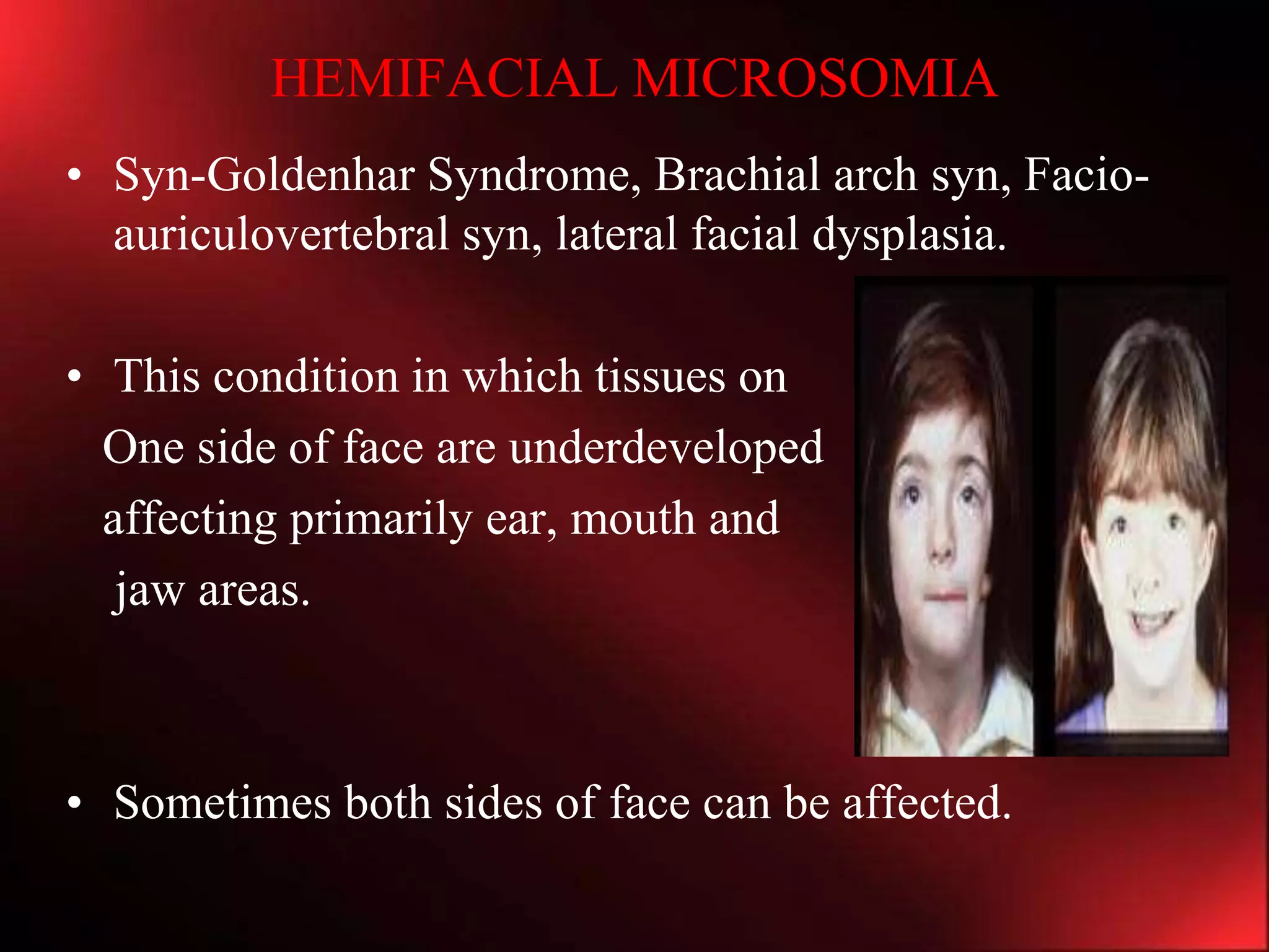 Muscles of facial expressions | PPTX