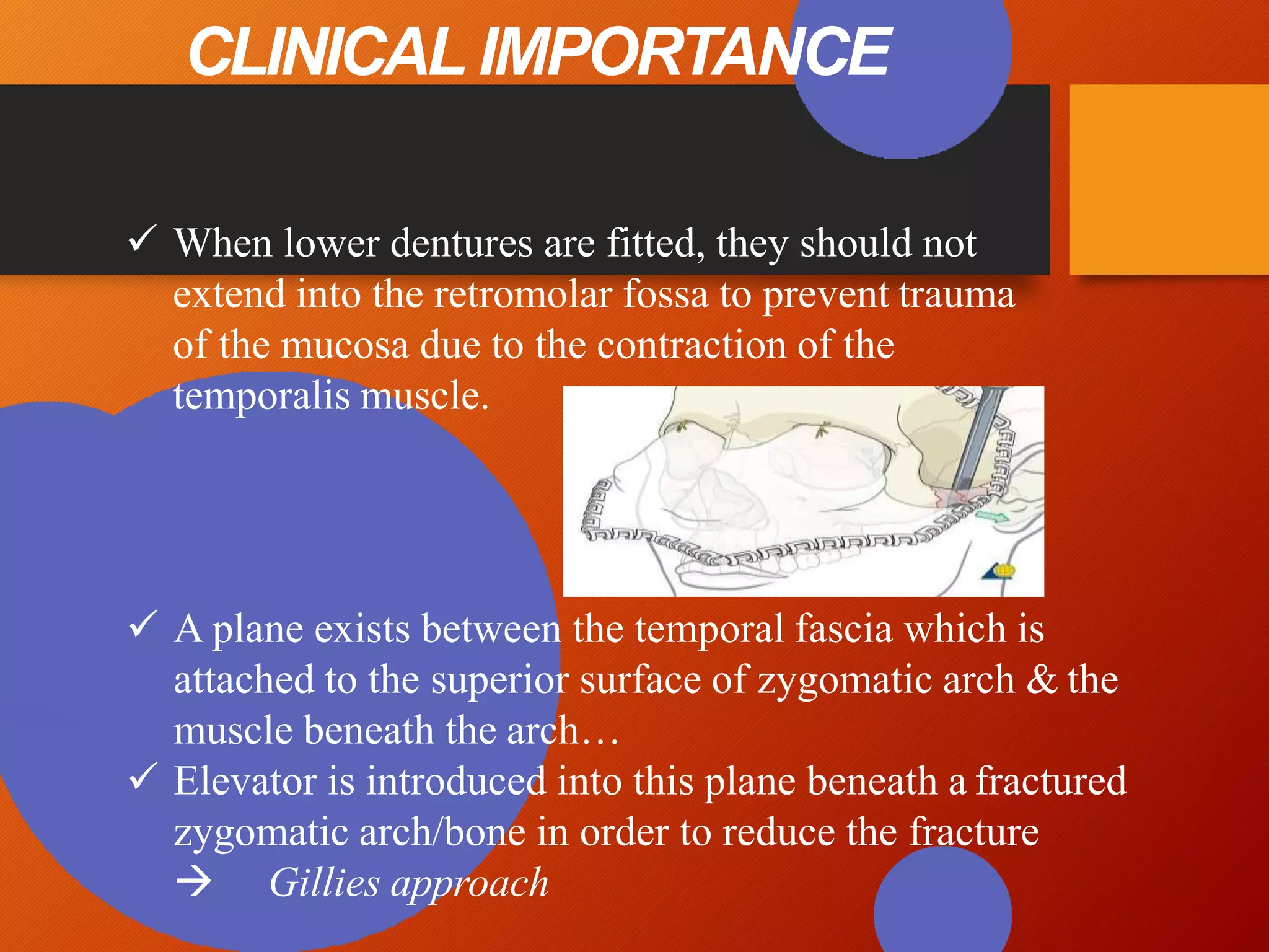 Muscles of masstication s2 | PPT