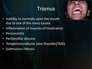 Muscles of mastication | PPT