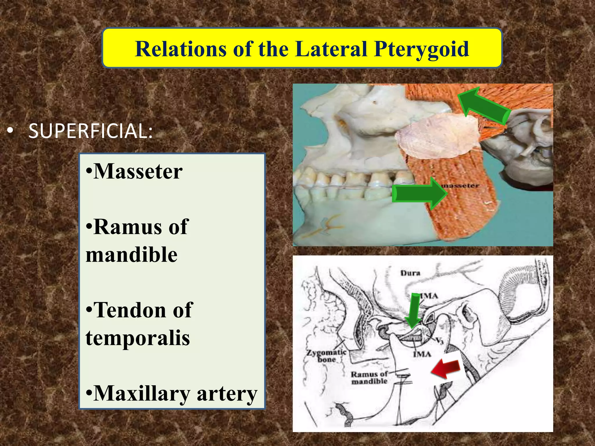 Muscles of mastication.ppt
