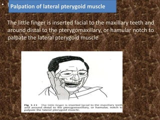 Muscles of mastication.ppt