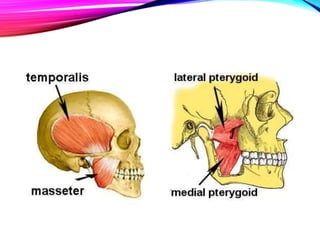 Muscles of mastication | PPTX