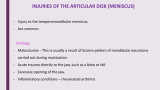 TMJ DISORDER - 2 | PPTX