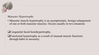 Muscles of mastication | PPT