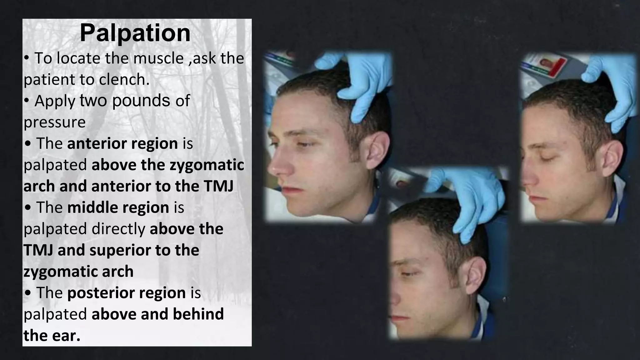 Muscles of mastication | PPTX