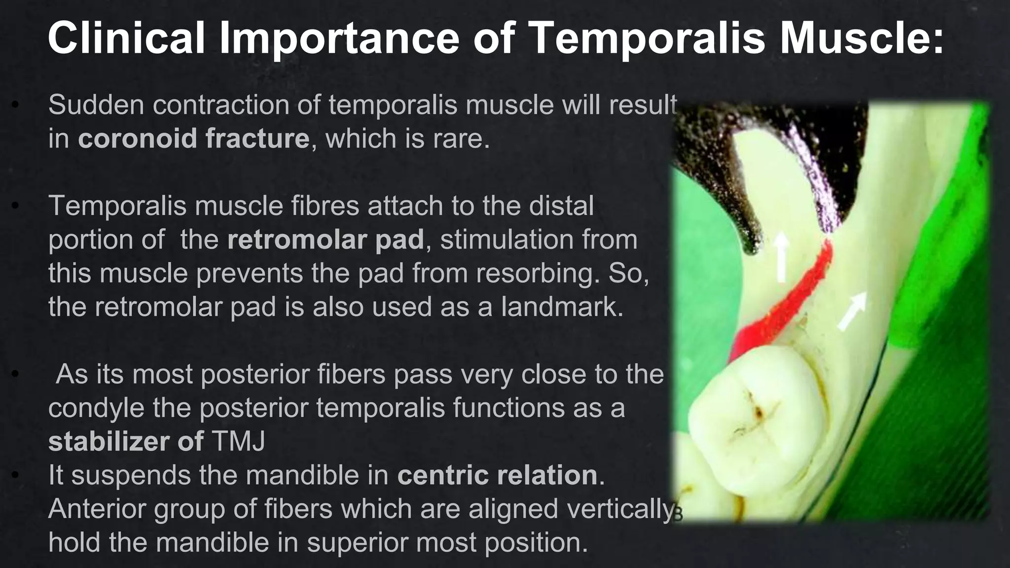 Muscles of mastication | PPTX