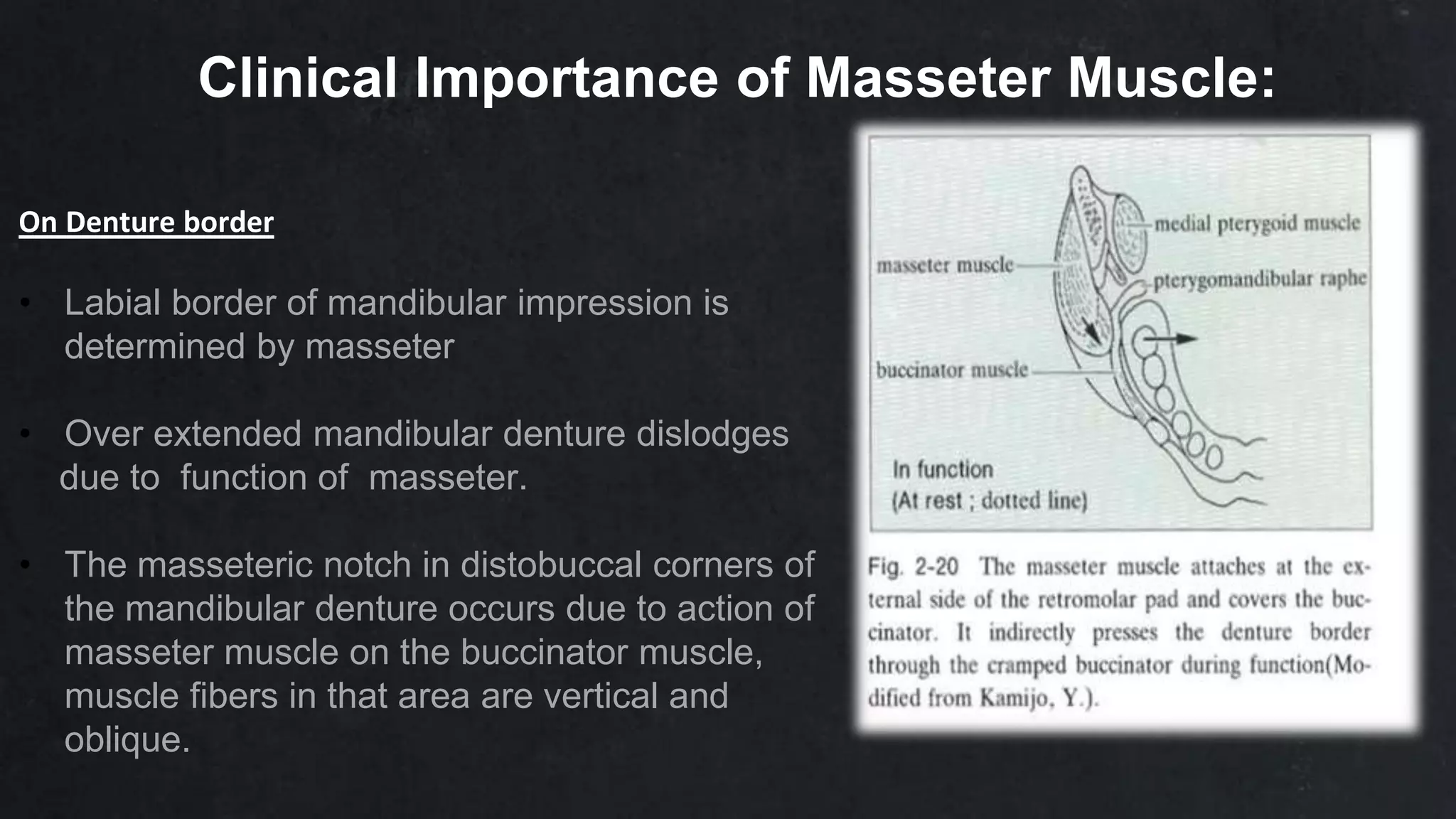 Muscles of mastication | PPTX