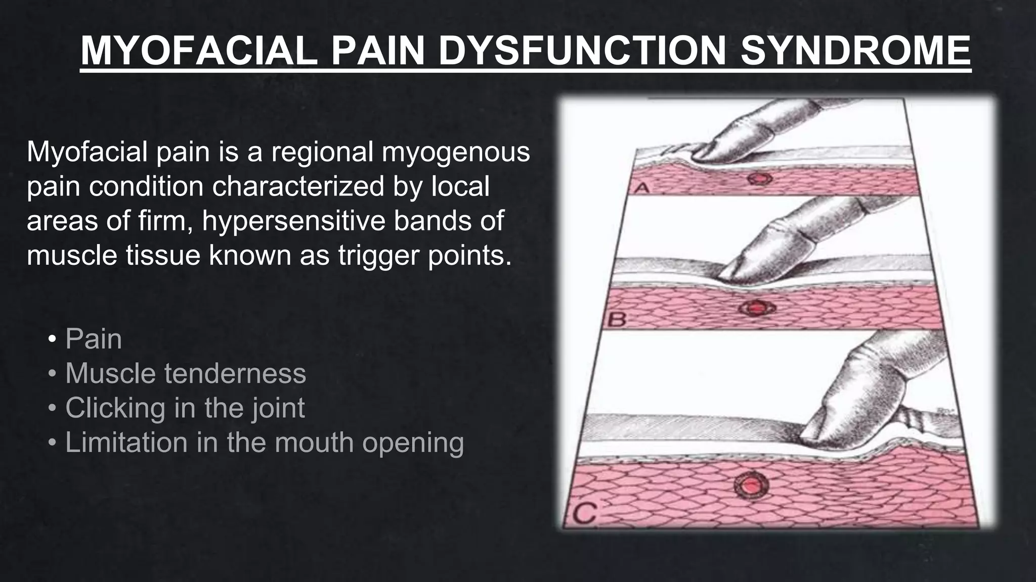 Muscles of mastication | PPTX