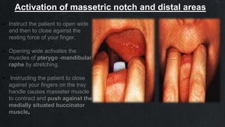 Muscles of mastication | PPTX