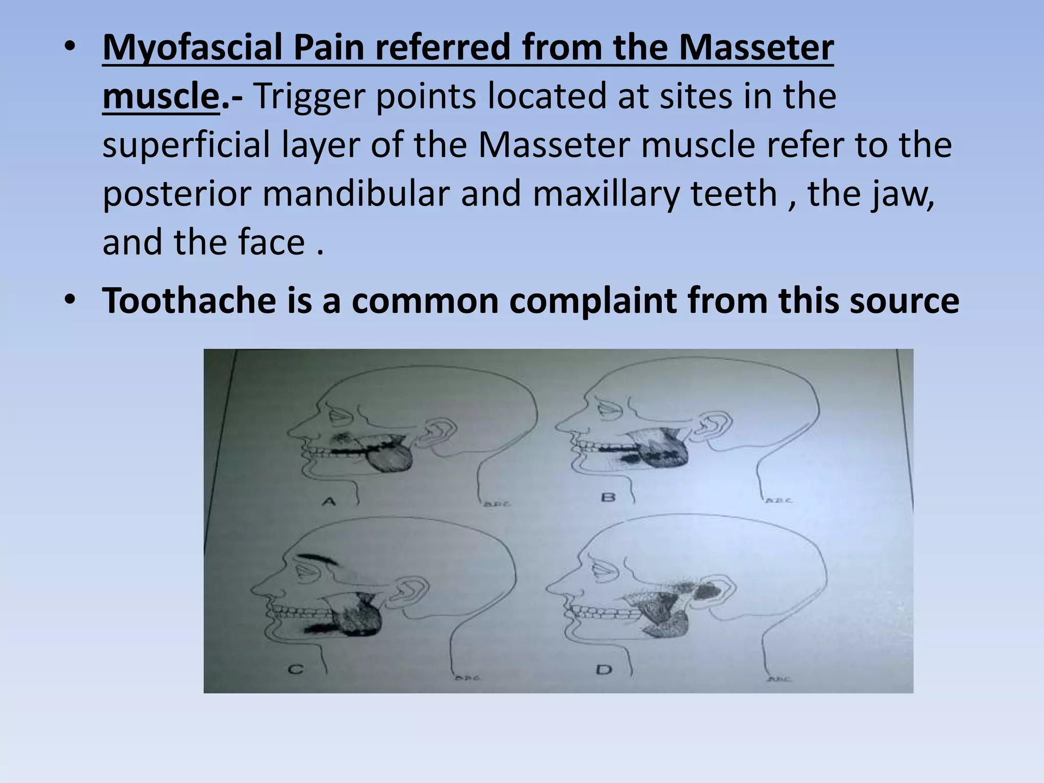 Muscles of mastication | PPTX