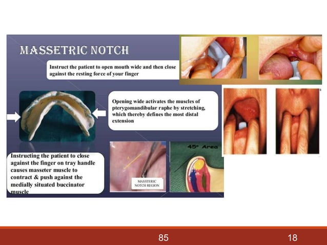 Muscles of mastication | PPTX | Dental Health | Diseases and Conditions