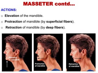 muscles_of_mastication.pptx