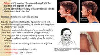 MUSCLES OF MASTICATION.pptx