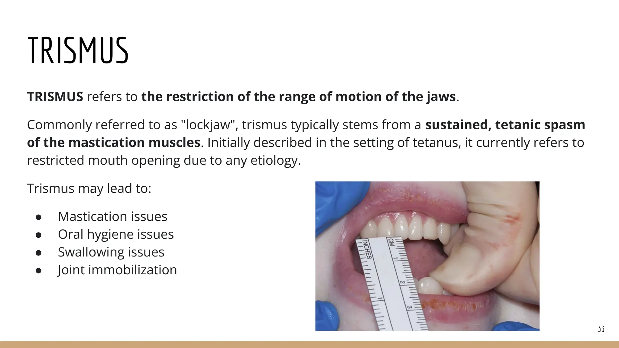 Primary and Accessory Muscles of Mastication | PDF