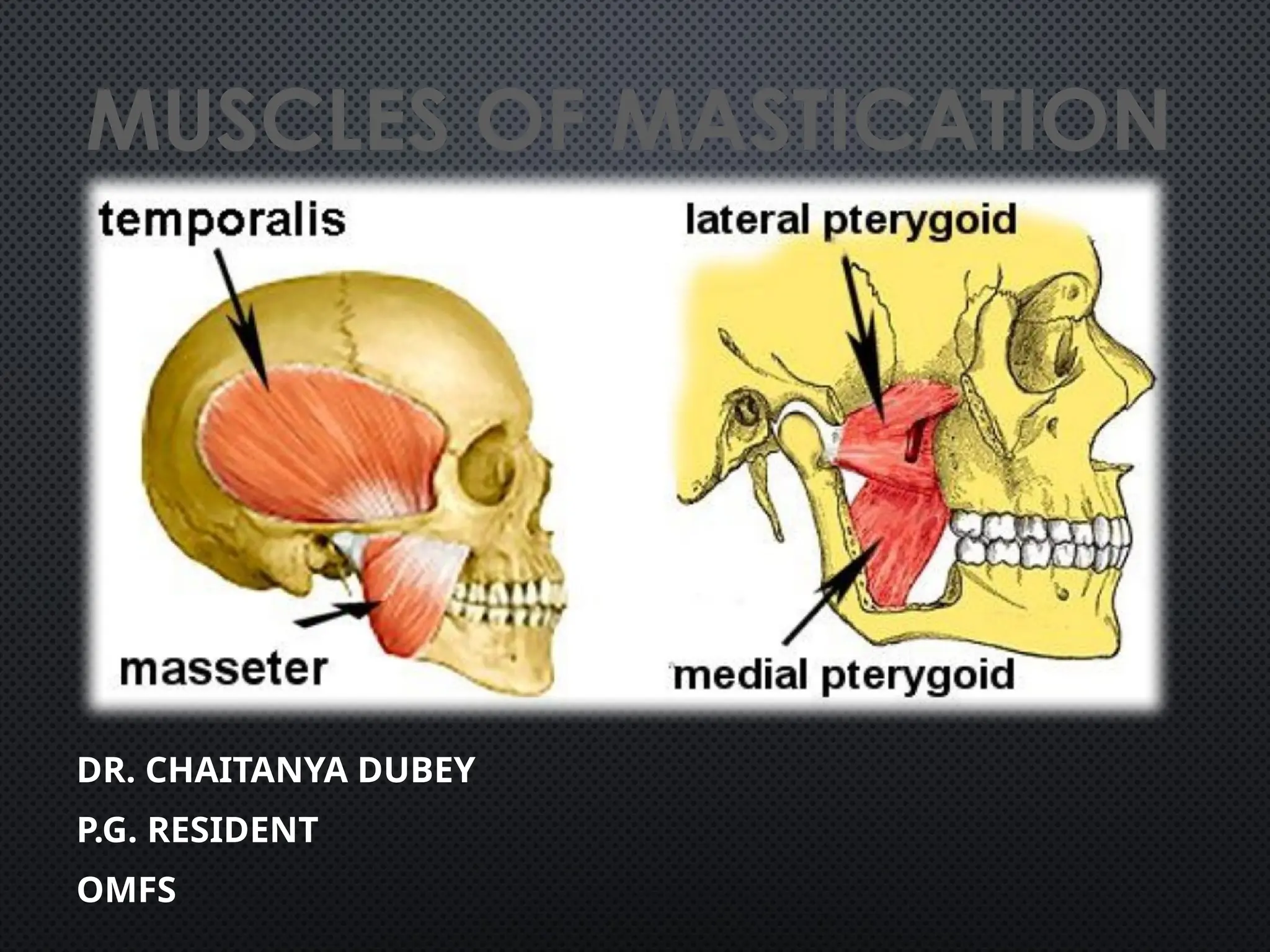 MUSCLES OF MASTICATION .pptx presentation | PPTX