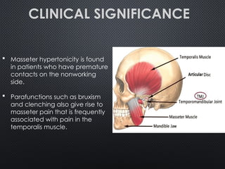 MUSCLES OF MASTICATION .pptx presentation | PPTX