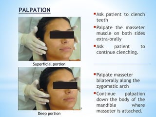 Muscles of mastication- Dr. Pankti Shah (PART I MDS) | PPT