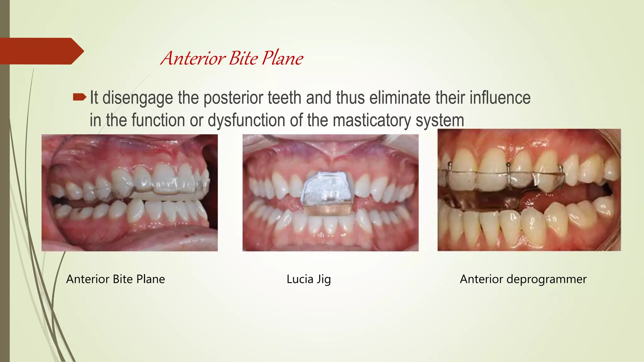 Muscles of mastication prosthodontic consideration | PPTX